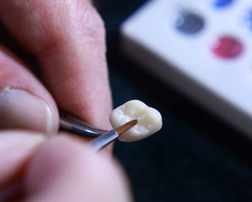 Ziemek Dental Lab | A Digital Dental Lab Looking To Serve You