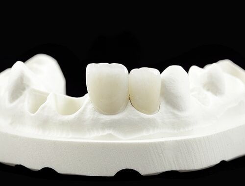 Our Difference | Ziemek Dental Lab | Olympia WA